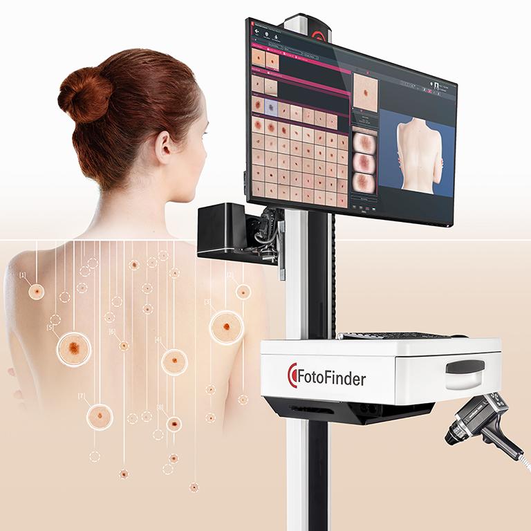 Какво представлява FotoFinder и за какво се използва?